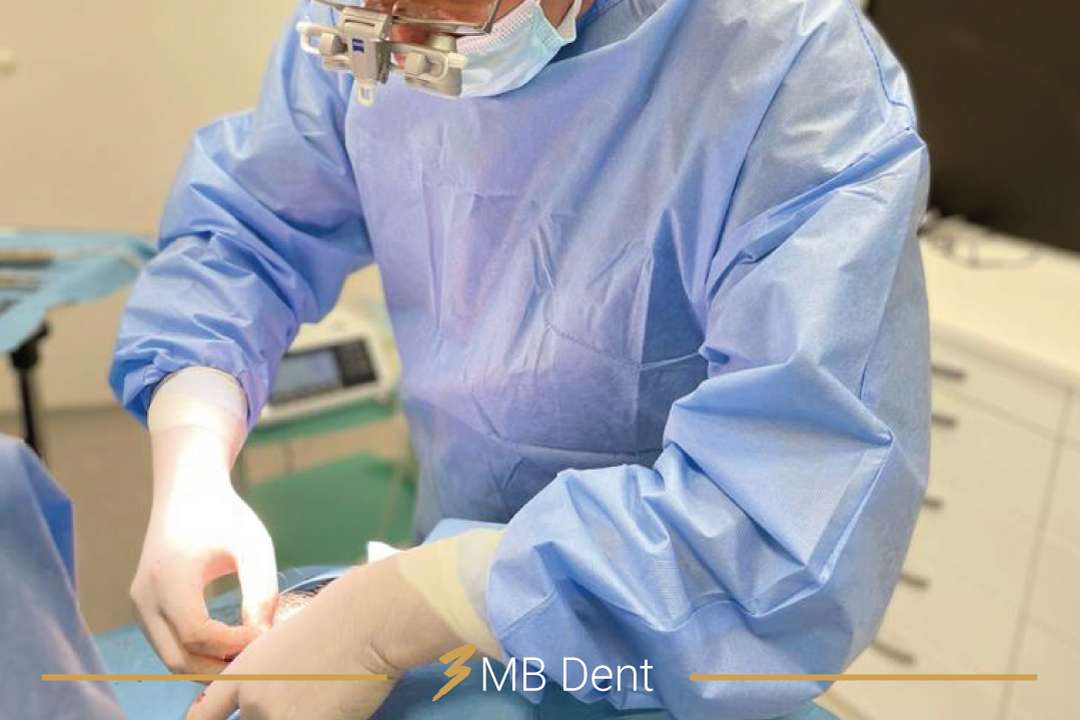 Kako znati je li impaktirani umnjak postaje problem? | MB dent