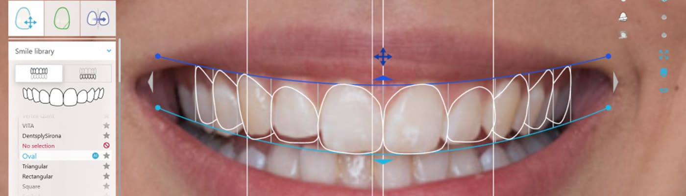 Smile Design (DSD - Digital Smile Design) | MB dent